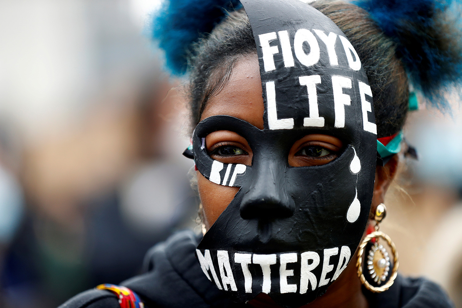 We Need a Pro-Poor and Pro-Black Response to COVID-19 | Think Global Health