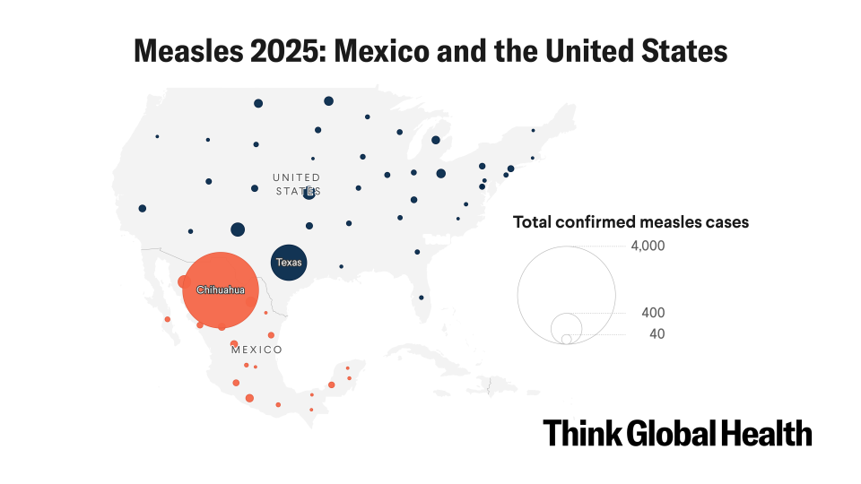 Measles Takes Root in Mexico | Think Global Health